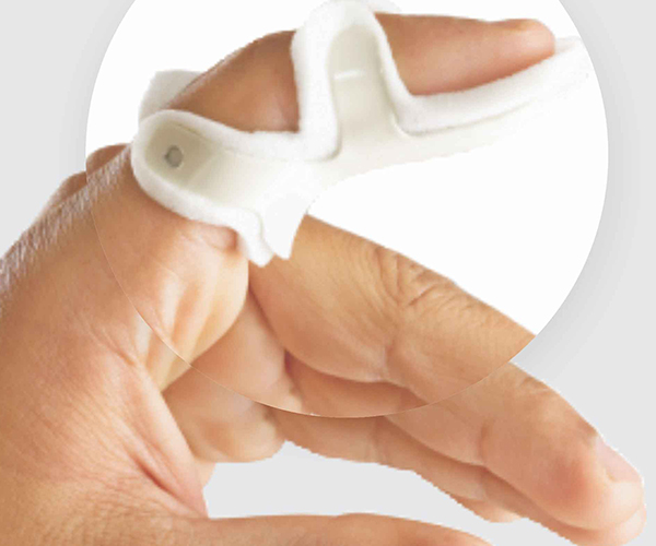 Frog Splint
